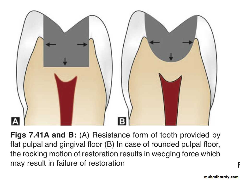 Principles Of Cavity Preparation Pptx Dr huda Muhadharaty Principles Of Cavity Preparation Pptx Dr huda Muhadharaty