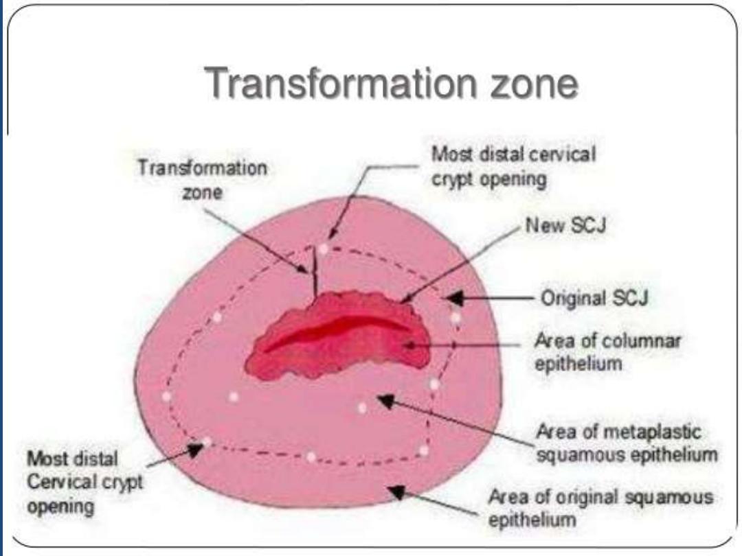 Premalignant And Malignant Conditions Of The Cervix Pdf All Lectures