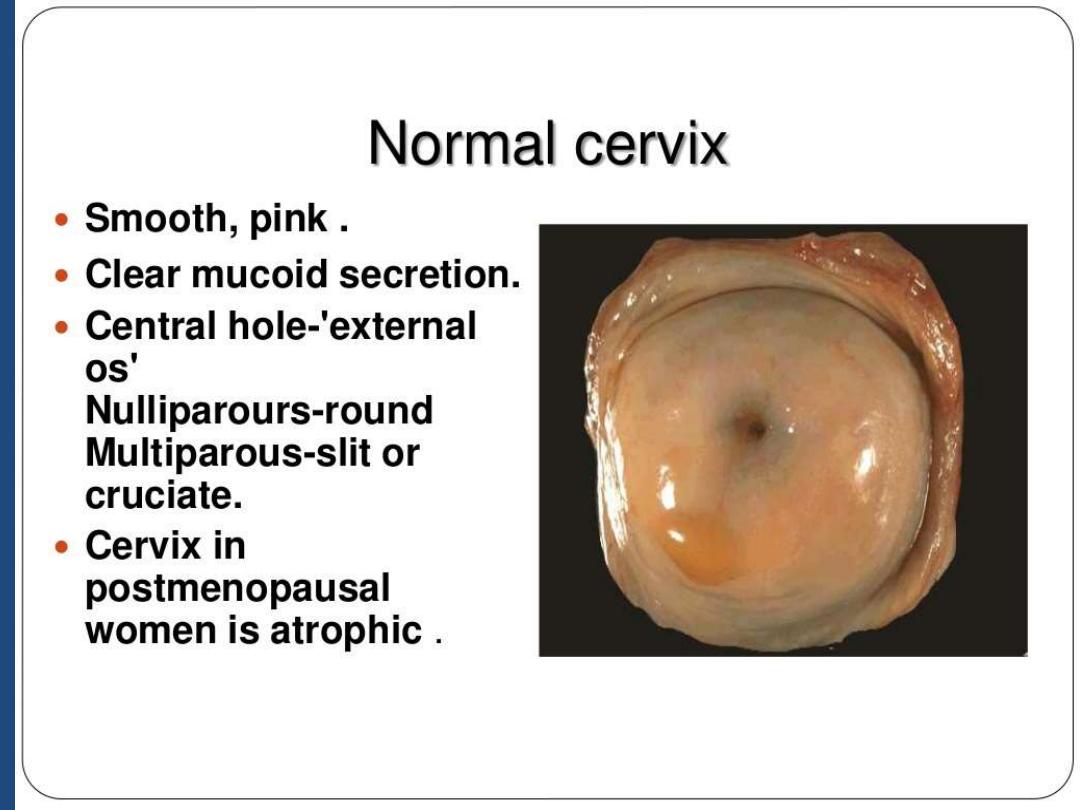 Premalignant And Malignant Conditions Of The Cervix Pdf All Lectures