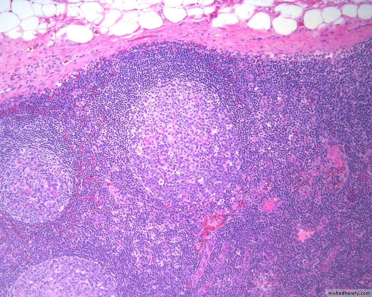 Histology Of A Lymph Node